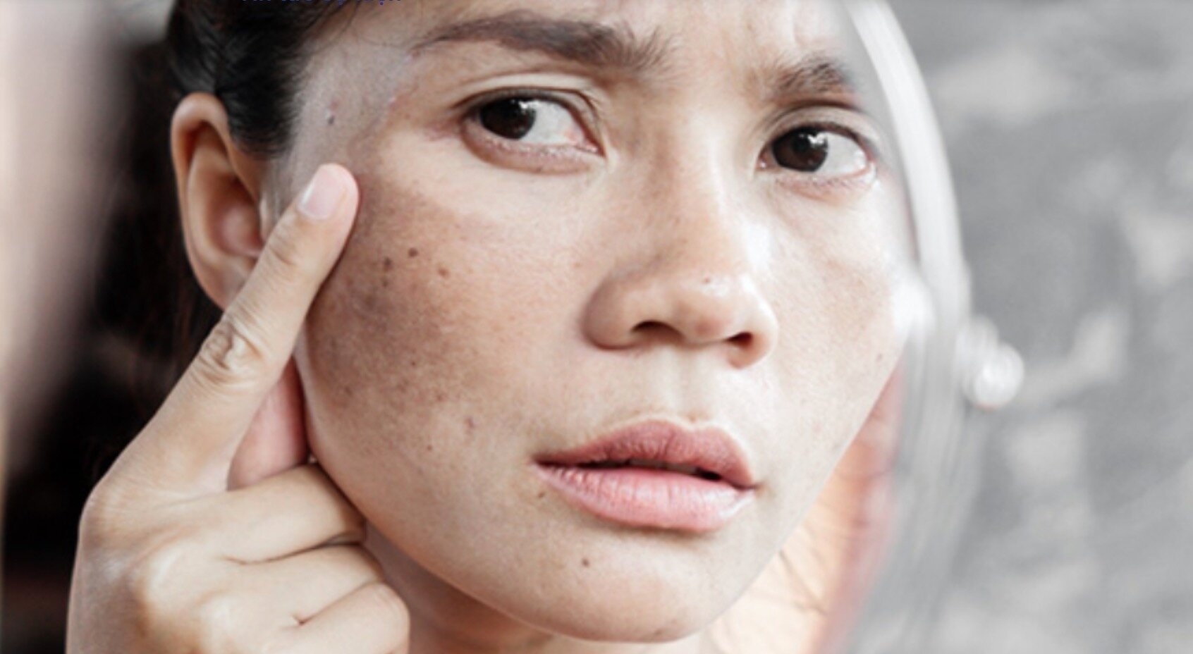 Tips to quickly fade age spots on the skin